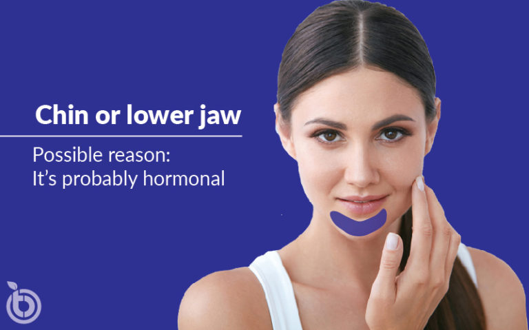 Acne Face Map: Why You Get Acne on Areas of Your Face — BioTrust